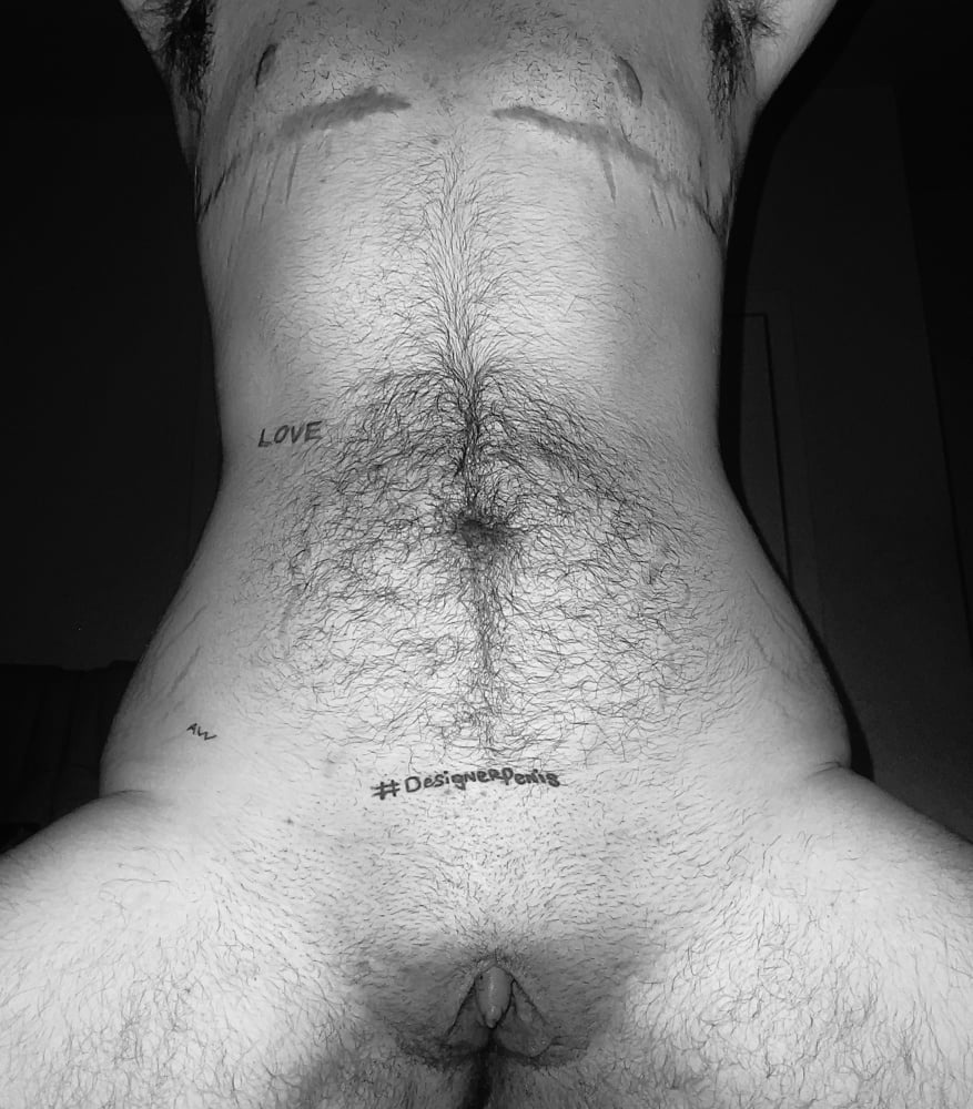 Trans Man Spread 2 Pics Xhamster