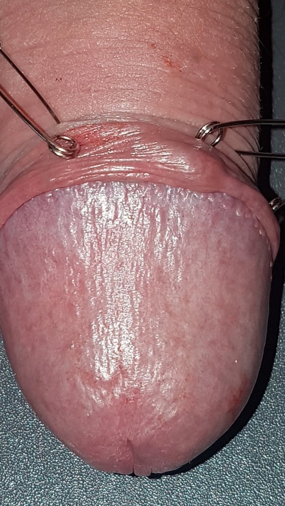 Cbt Needles 41 Pics Xhamster