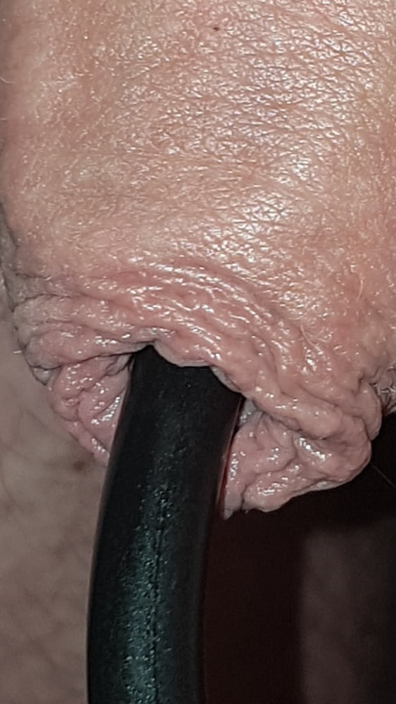 Urethral Insertion 80 Pics 2 Xhamster